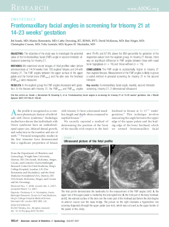 (PDF) Frontomaxillary facial angles in screening for trisomy 21 at 14 ...