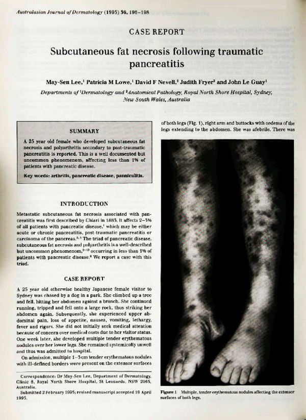 (PDF) Subcutaneous fat necrosis following traumatic pancreatitis