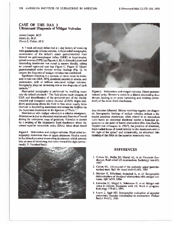 (PDF) Ultrasound diagnosis of midgut volvulus