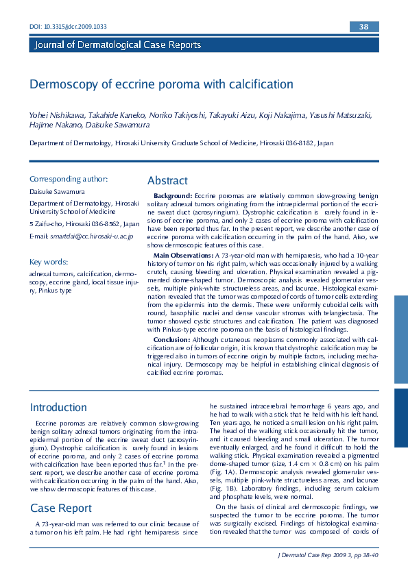 (PDF) Dermoscopy of eccrine poroma with calcification
