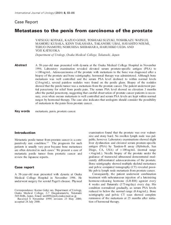 (PDF) Nodules on the glans penis, an unusual metastatic pattern of ...