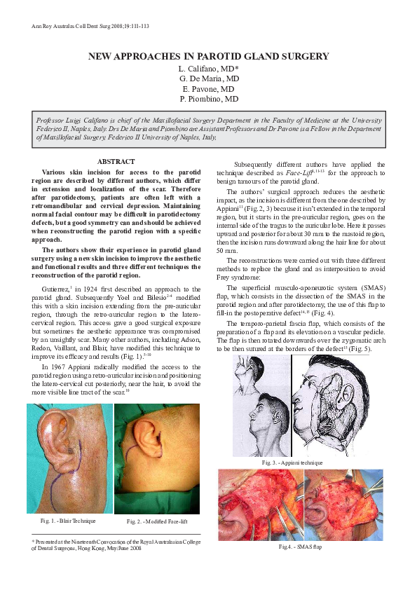 (PDF) New approaches in parotid gland surgery | Pasquale Piombino ...