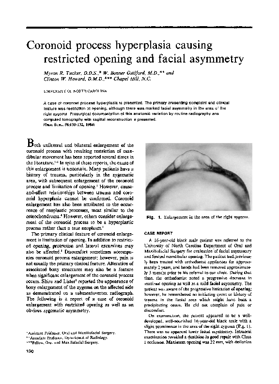 (PDF) Coronoid process hyperplasia causing restricted opening and ...