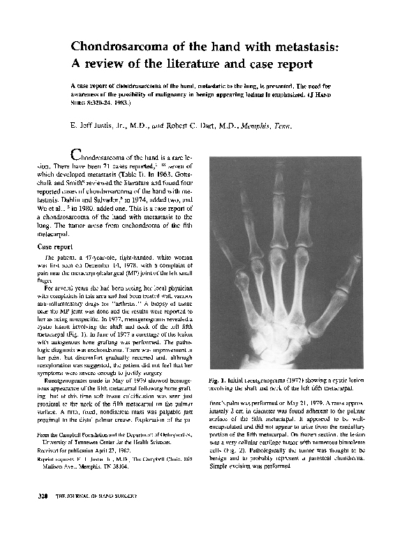 (PDF) Chondrosarcoma of the hand with metastasis: A review of the ...