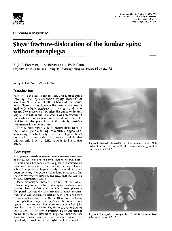 (PDF) Shear fracture-dislocation of the lumbar spine without paraplegia