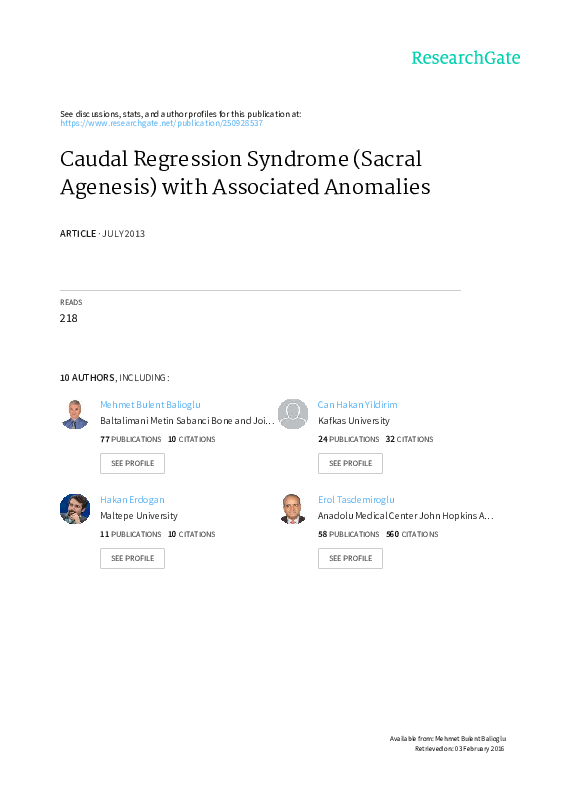 (PDF) Caudal Regression Syndrome (Sacral Agenesis) with Associated ...