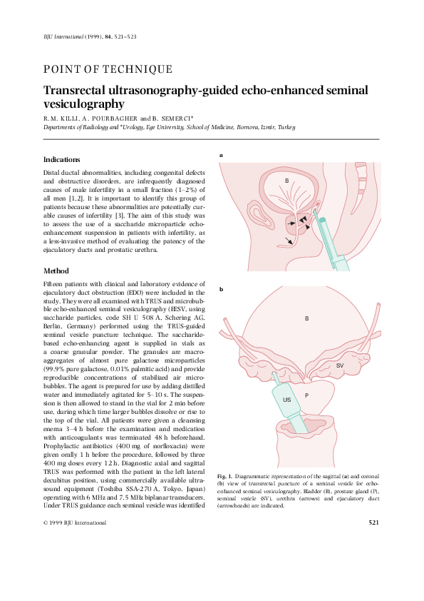 (PDF) Transrectal ultrasonography-guided echo-enhanced seminal ...