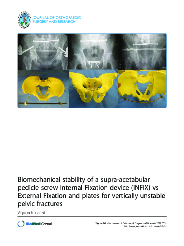 (PDF) Biomechanical stability of a supra-acetabular pedicle screw ...