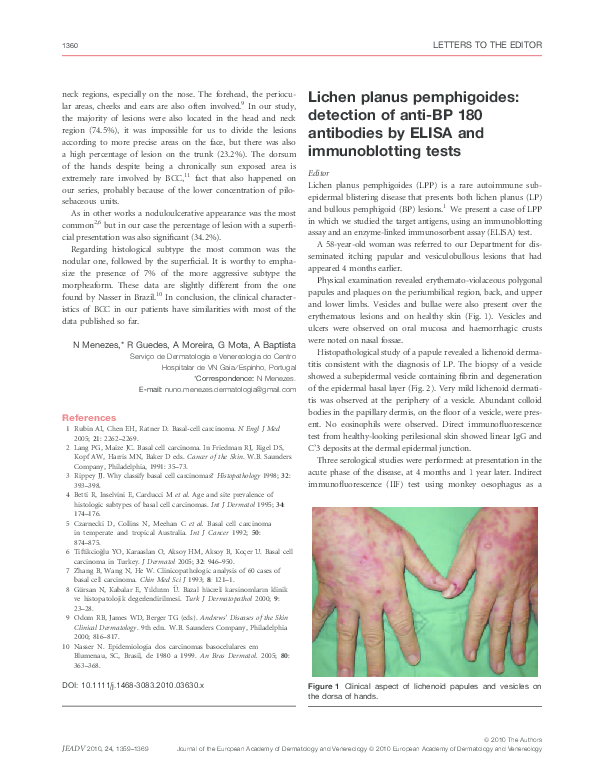 (PDF) Lichen planus pemphigoides: detection of anti-BP 180 antibodies ...