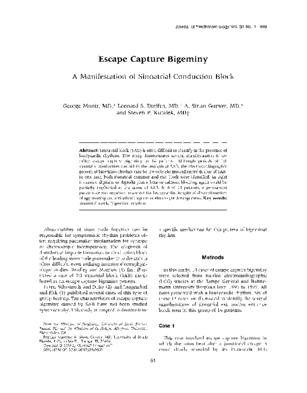 (PDF) Escape capture bigeminy | George Monir - Academia.edu