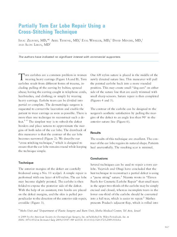 (PDF) Partially Torn Ear Lobe Repair Using a Cross-Stitching Technique