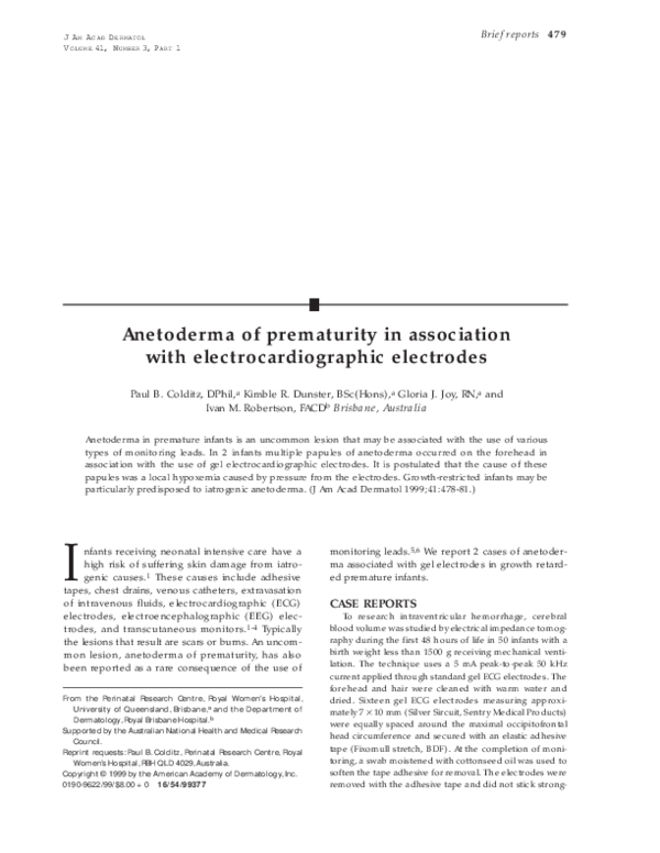 (PDF) Anetoderma of prematurity in association with ...