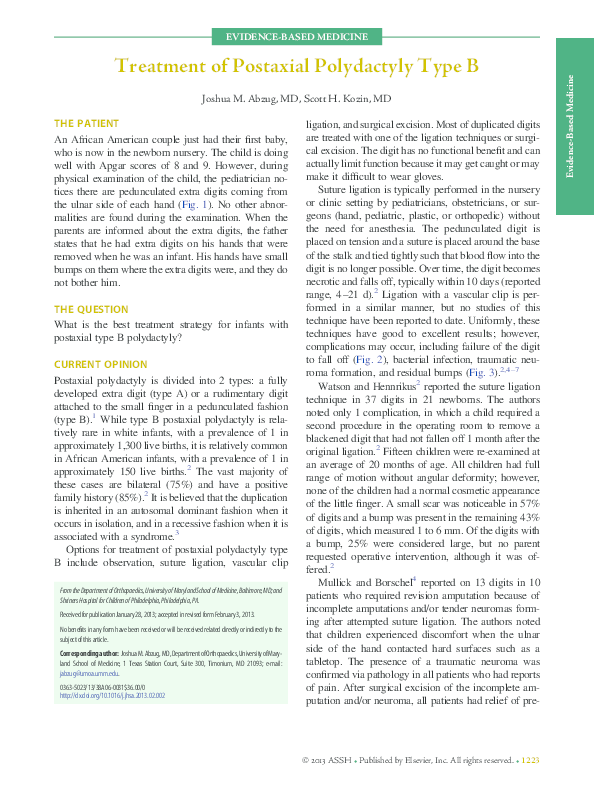(PDF) Treatment of Postaxial Polydactyly Type B