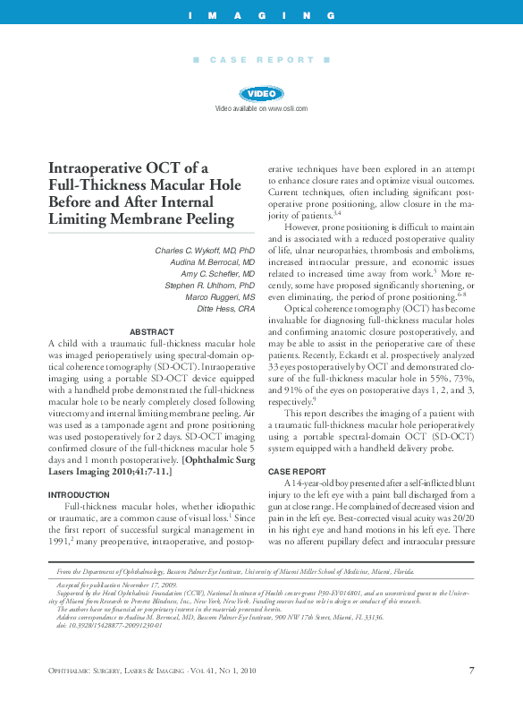 (PDF) Intraoperative OCT of a Full-Thickness Macular Hole Before and After Internal Limiting ...
