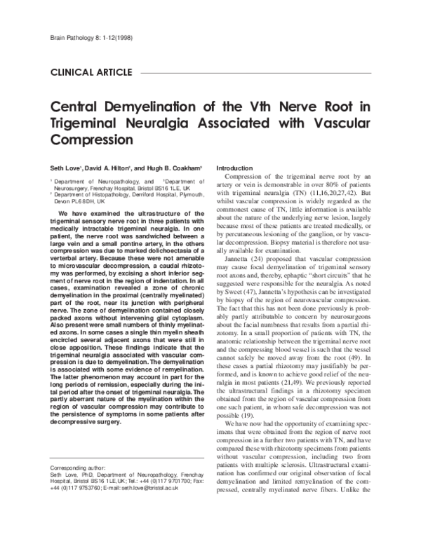 (PDF) Central Demyelination of the Vth Nerve Root in Trigeminal ...