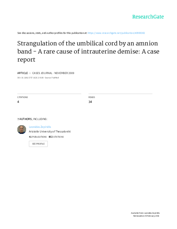 (PDF) Strangulation of the umbilical cord by an amnion band - a rare ...