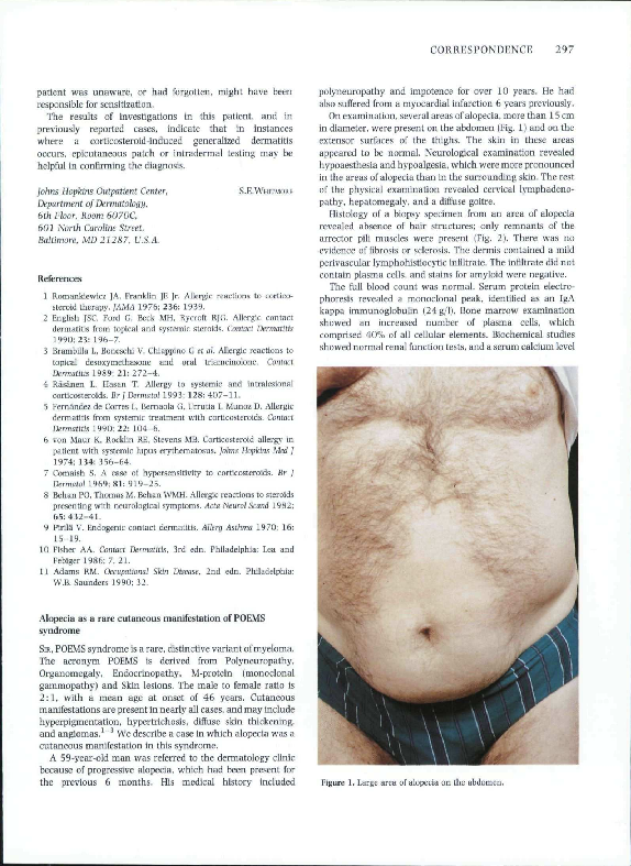 (PDF) Alopecia as a rare cutaneous manifestation of POEMS syndrome