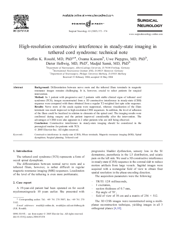 interference terminale s
