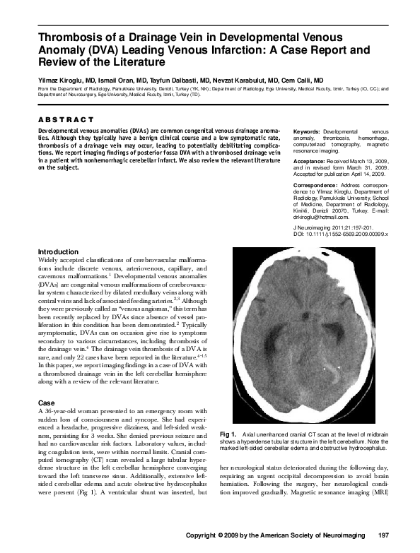 (PDF) Thrombosis of a Drainage Vein in Developmental Venous Anomaly ...