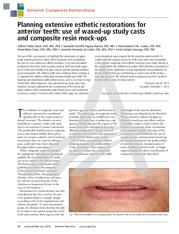 (PDF) Planning extensive esthetic restorations for anterior teeth: use ...