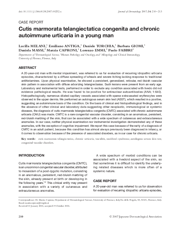 (PDF) Cutis marmorata telangiectatica congenita and glaucoma