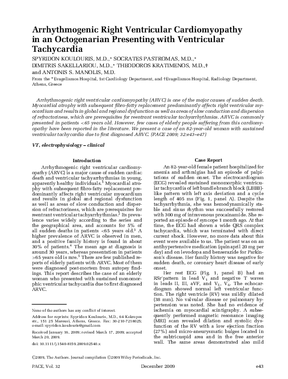 (PDF) Ventricular Tachycardia as a First Presentation of Arrhythmogenic Right Ventricular ...
