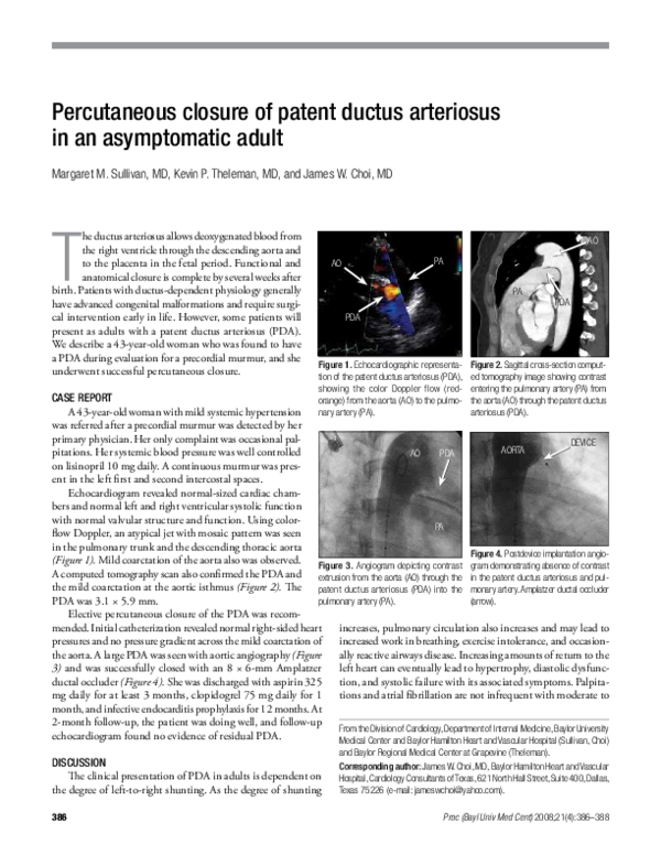 (PDF) Percutaneous closure of patent ductus arteriosus in children ...