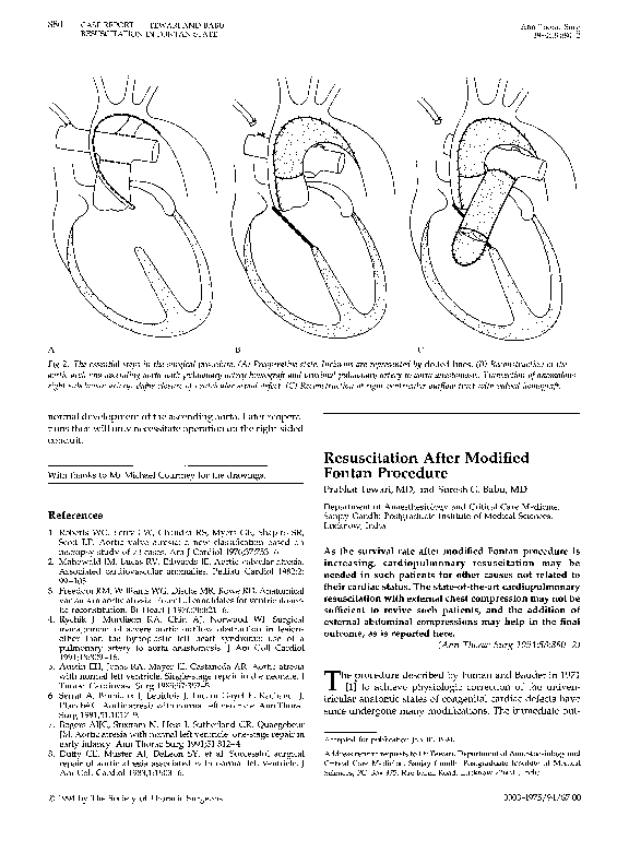 (PDF) Resuscitation after modified fontan procedure
