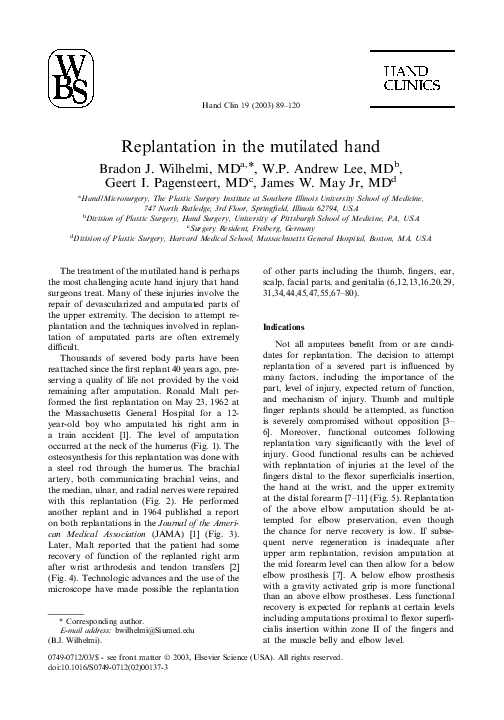 (PDF) Replantation in the mutilated hand