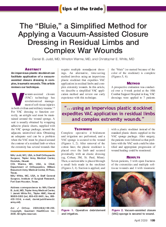 (PDF) The "bluie," a simplified method for applying a vacuum-assisted ...