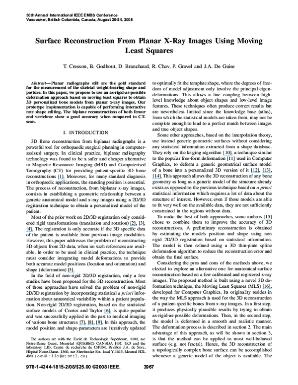 (PDF) Surface reconstruction from planar x-ray images using moving least squares