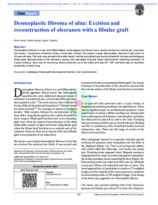 (PDF) Desmoplastic fibroma of ulna: Excision and reconstruction of ...