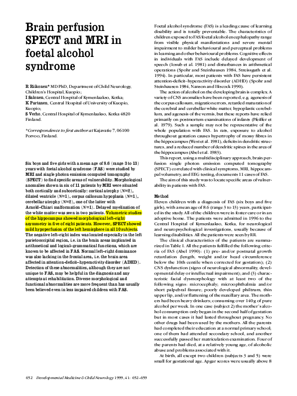 (PDF) Brain perfusion SPECT and MRI in foetal alcohol syndrome