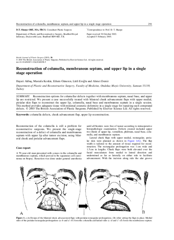 (PDF) Reconstruction of columella, membranous septum, and upper lip in ...