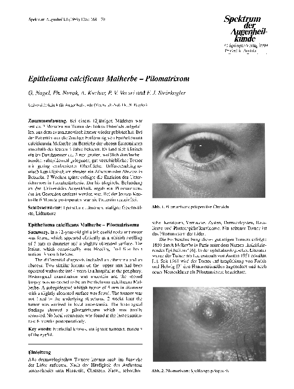 (PDF) Epithelioma calcificans Malherbe — Pilomatrixom