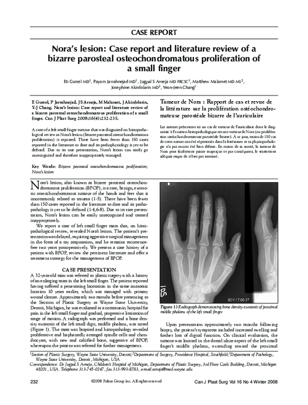 (PDF) Nora's lesion: Case report and literature review of a bizarre ...
