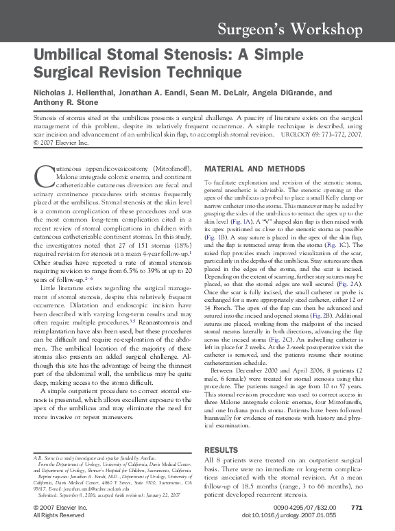 (PDF) Umbilical Stomal Stenosis: A Simple Surgical Revision Technique