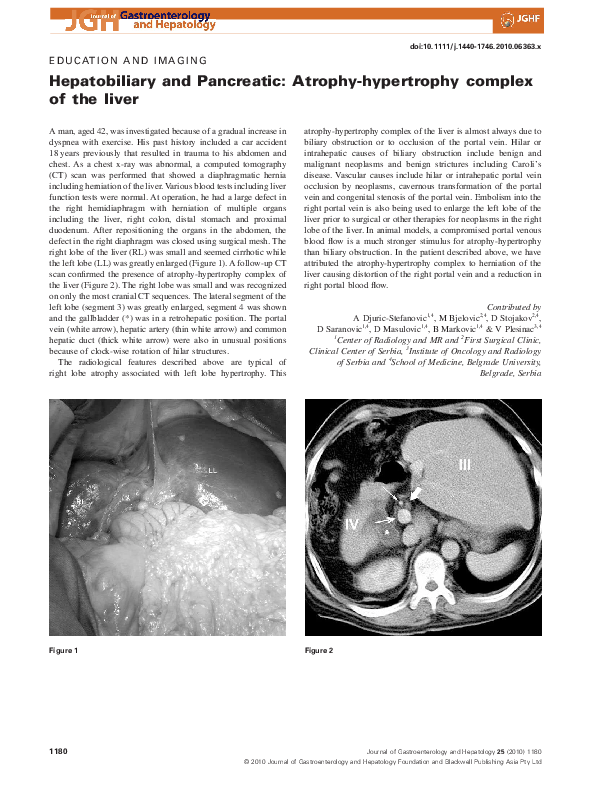 (PDF) Hepatobiliary and Pancreatic: Atrophy-hypertrophy complex of the ...