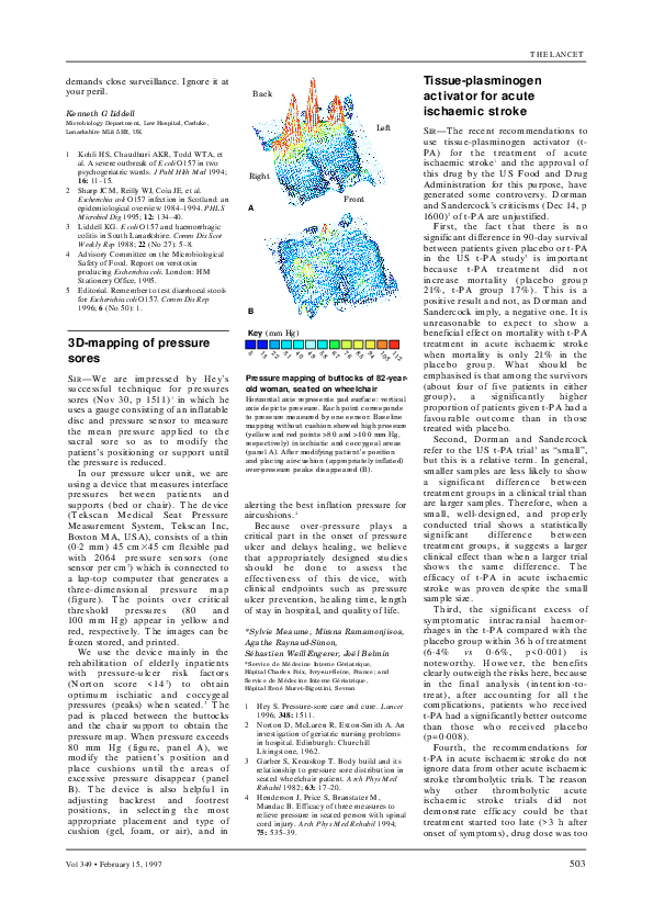 (PDF) 3D-mapping of pressure sores