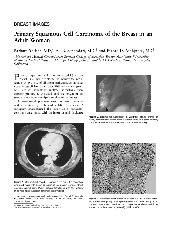 Pdf Primary Squamous Cell Carcinoma Of The Breast In An Adult Woman