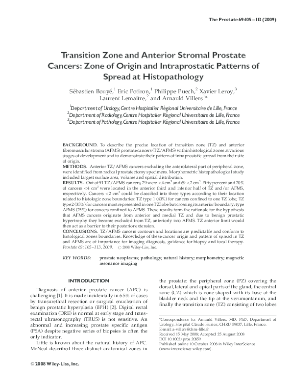 (PDF) Transition zone and anterior stromal prostate cancers: Zone of ...