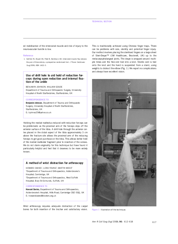 (PDF) A method of wrist distraction for arthroscopy