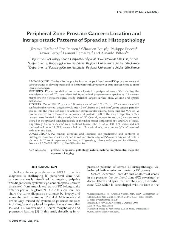 (PDF) Peripheral zone prostate cancers: Location and intraprostatic ...