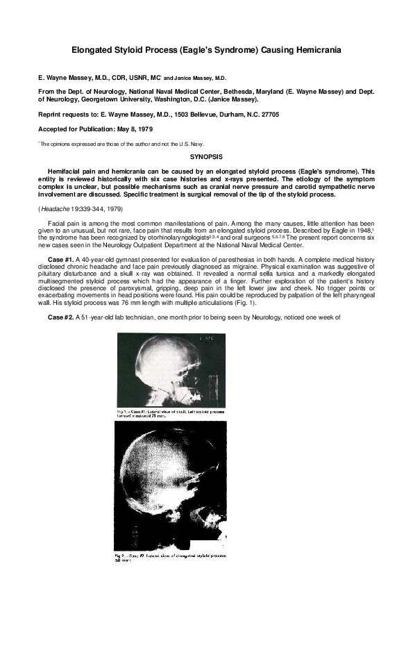 (PDF) Elongated Styloid Process (Eagle's Syndrome) Causing Hemicrania