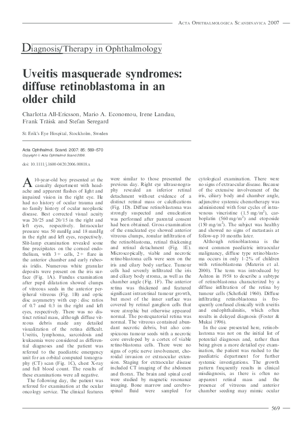 (PDF) Uveitis masquerade syndromes: diffuse retinoblastoma in an older ...