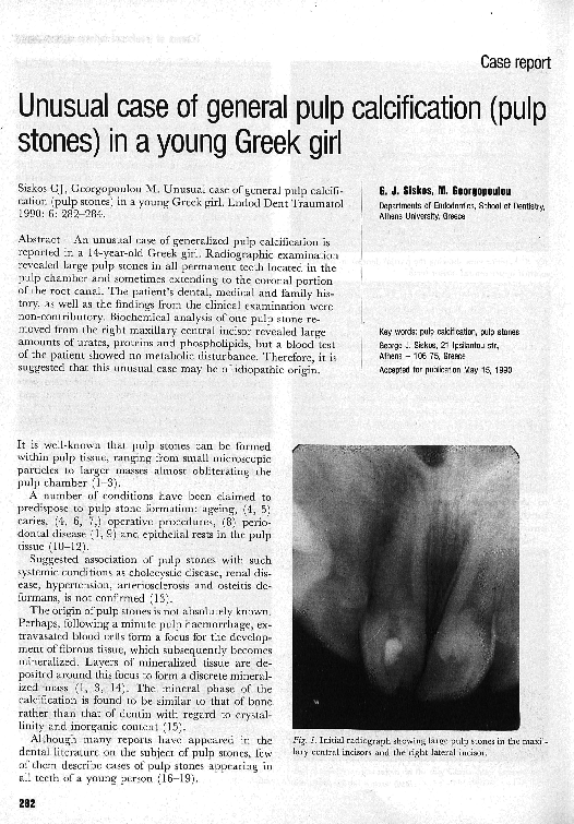 (PDF) Unusual case of general pulp calcification (pulp stones) in a ...