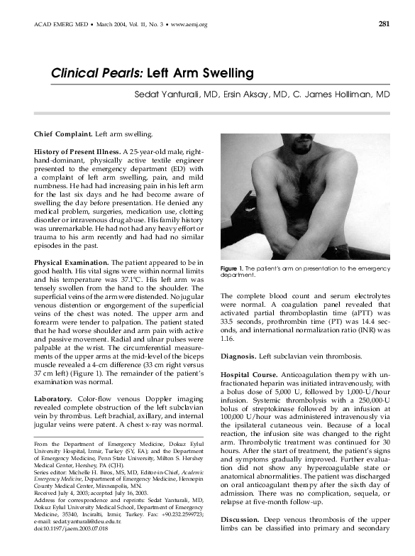 (PDF) Clinical Pearls: Left Arm Swelling