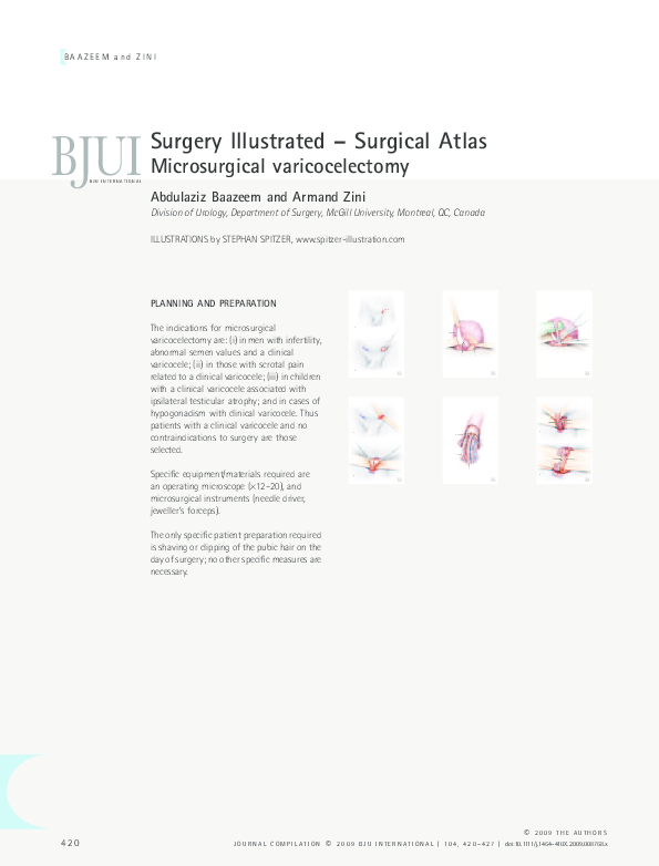 (PDF) Surgery Illustrated - Surgical Atlas Microsurgical varicocelectomy