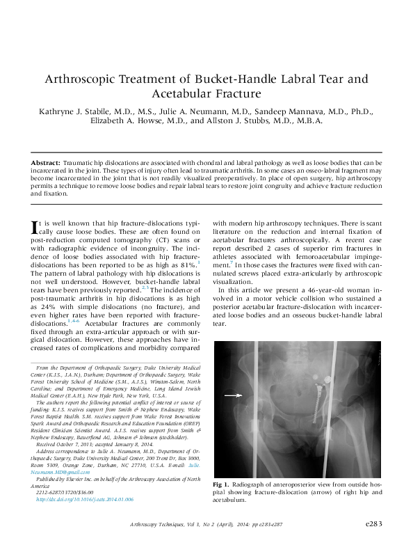 (PDF) Arthroscopic Treatment of Bucket-Handle Labral Tear and ...