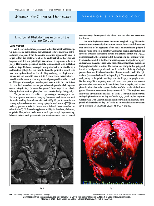 (PDF) Pleomorphic rhabdomyosarcoma of the uterine corpus--a case report ...